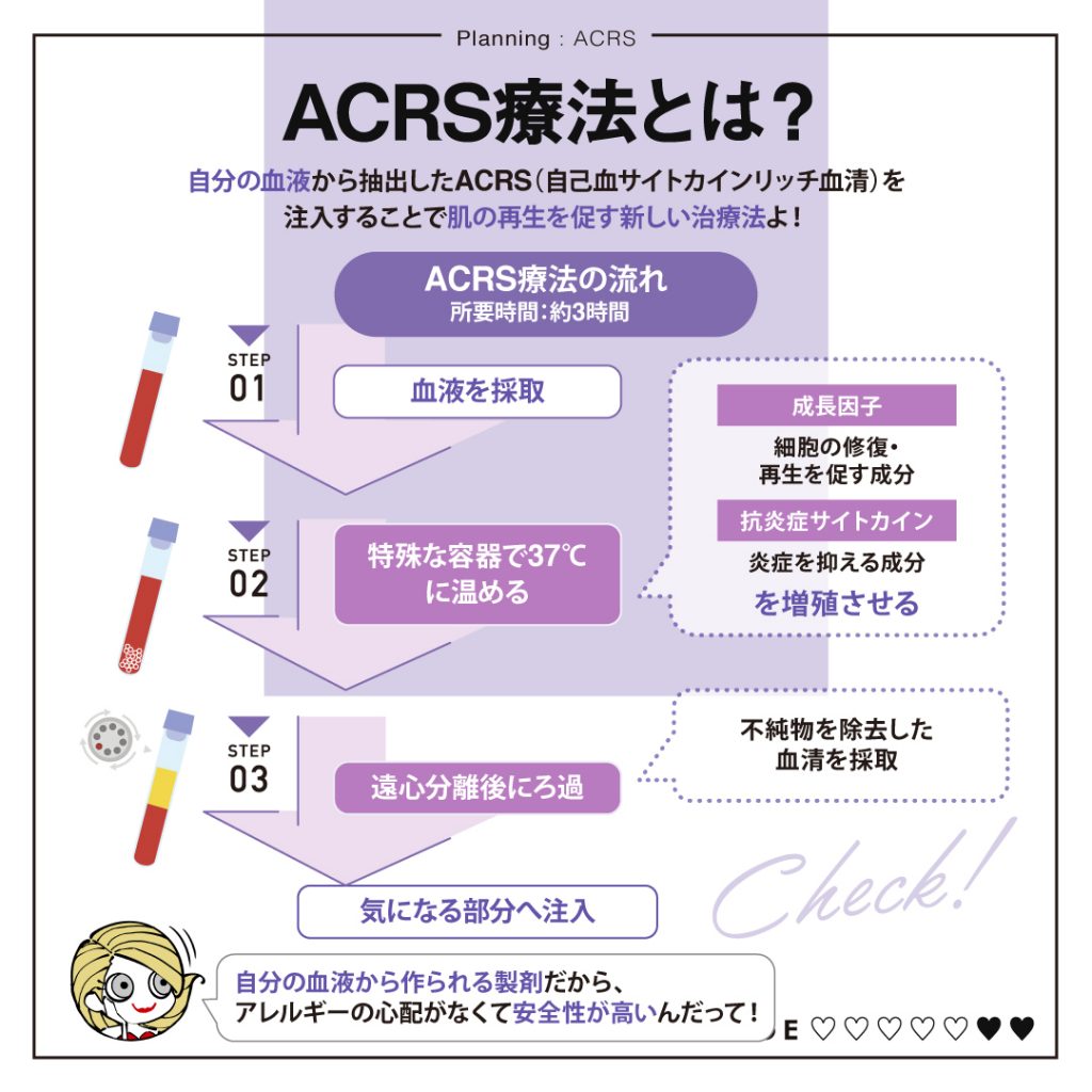 ACRS療法とは？ 次世代PRP療法ともいわれるその効果の秘密を徹底解説！ - 美容ヒフコ